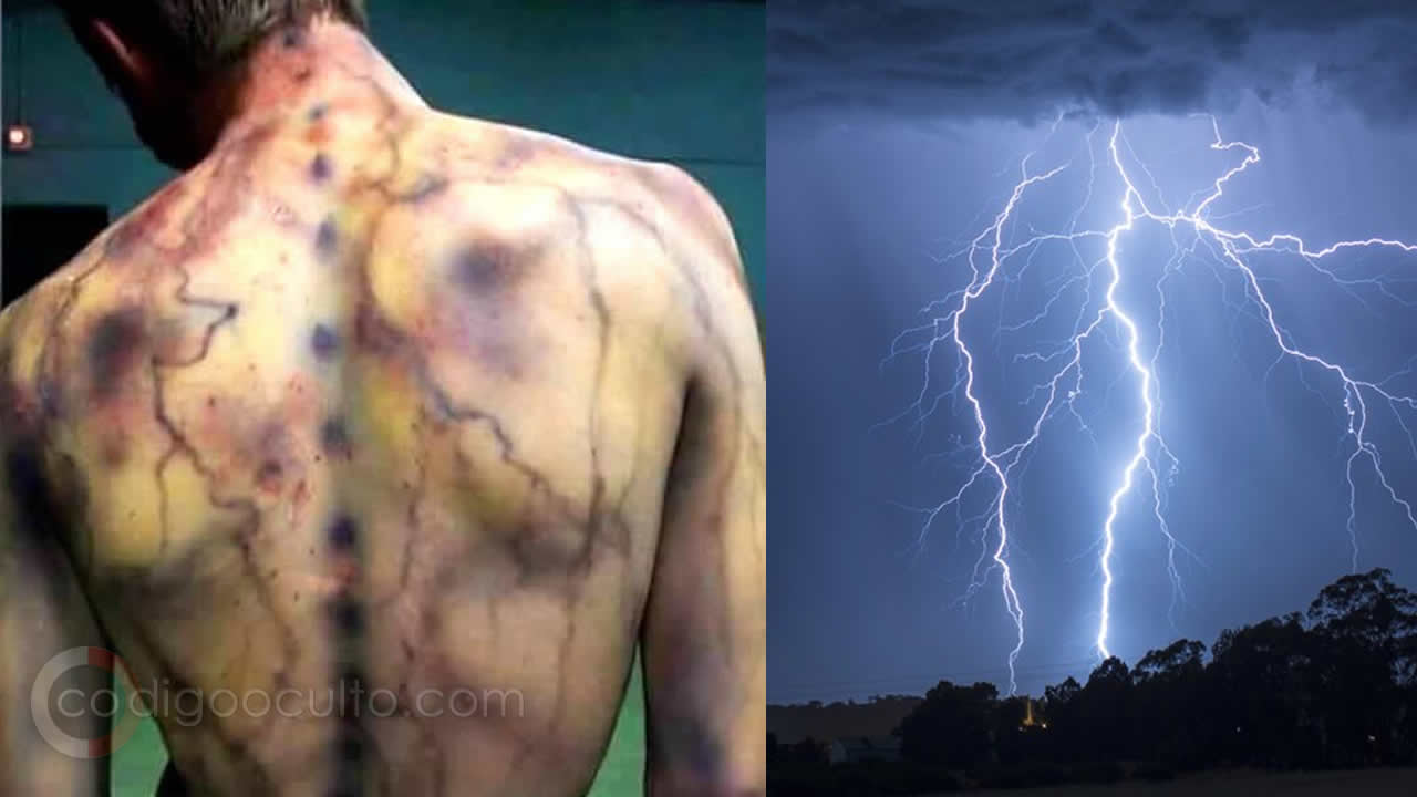 ¿Qué ocurre en el cuerpo cuando le cae un rayo? | CODIGO OCULTO
