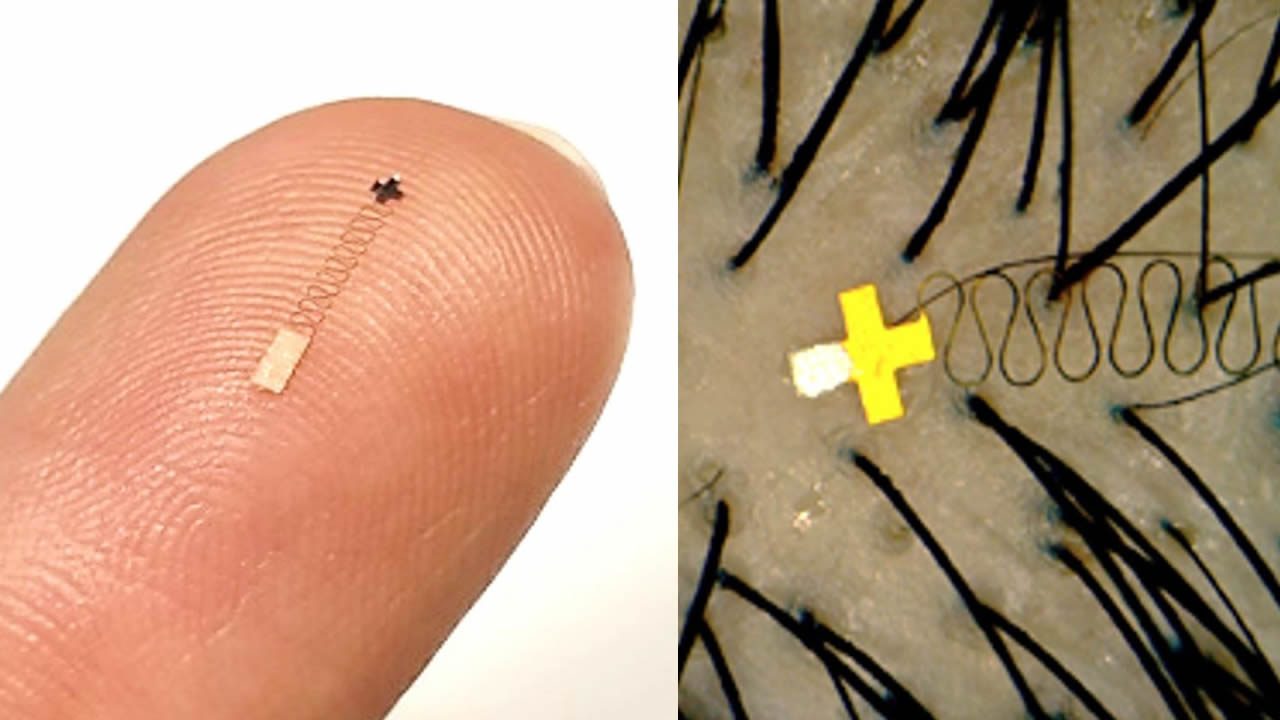 Desarrollan un sensor cerebral a nanoescala que logra una precisión del ...